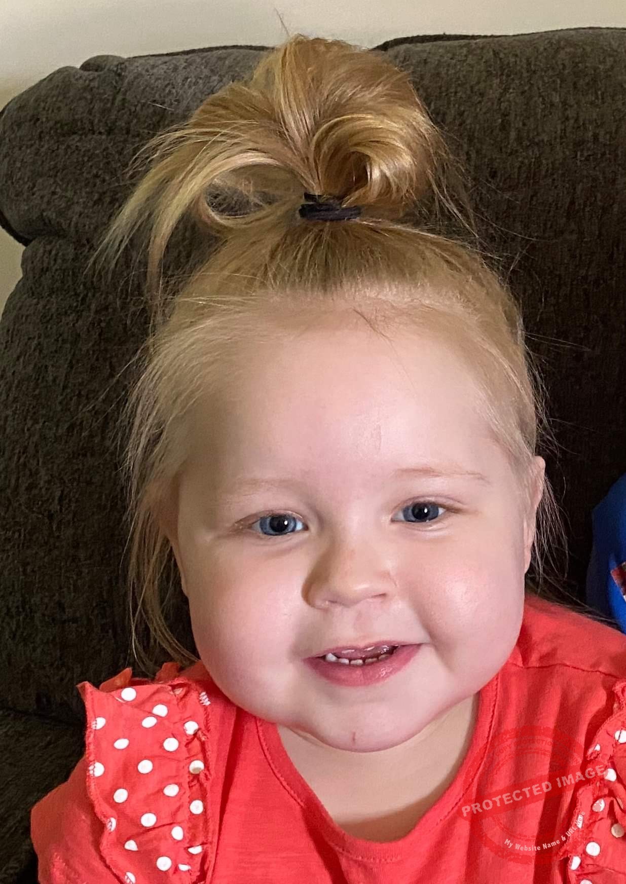 Ayla becomes the poster girl for Bandaged Bear Appeal – The Cobar Weekly